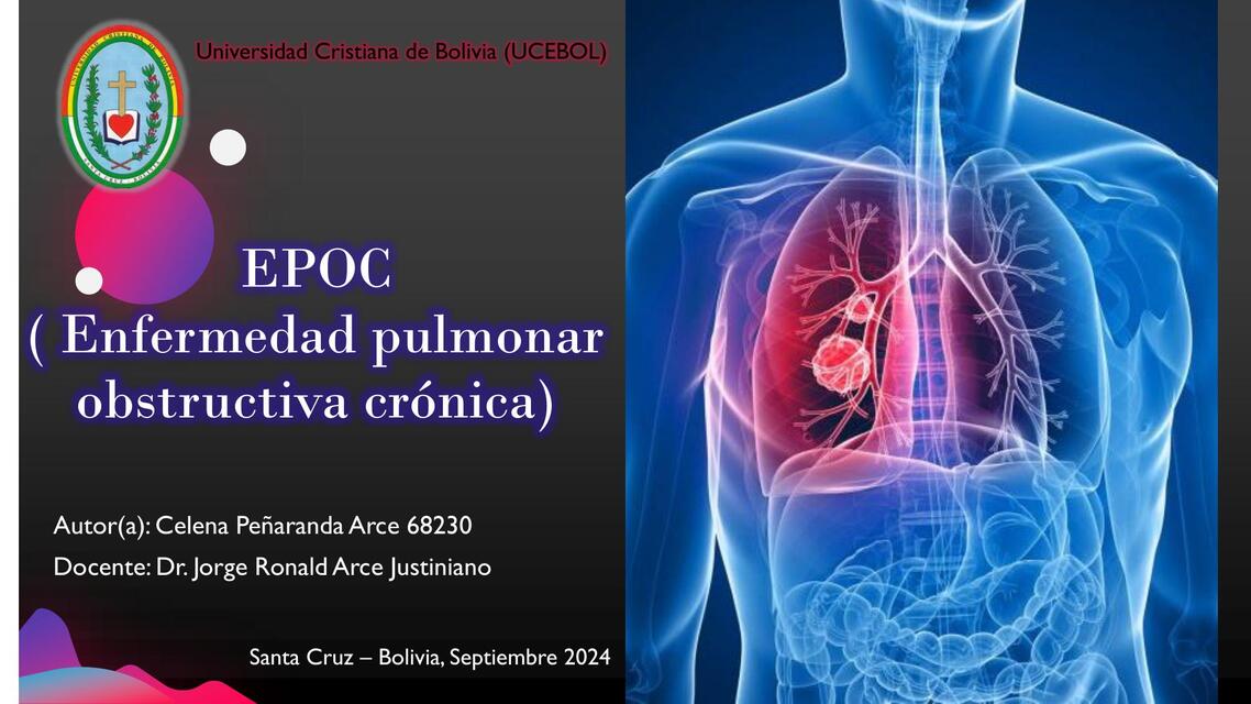 Flashcards de EPOC | Por Celena | uDocz