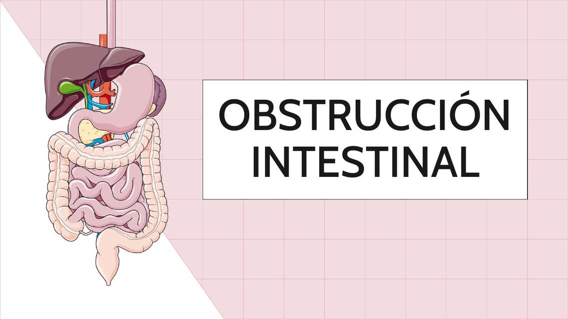 Flashcards de obstrucción intestinal | Por Lupita | uDocz