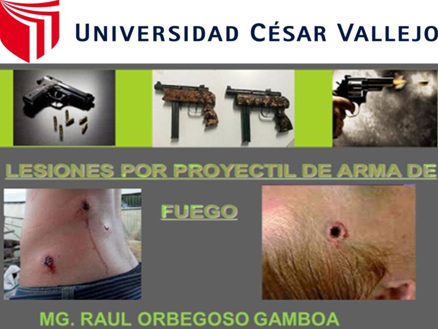 SESIÓN 5 MEDICINA LEGAL LESIONES POR PROYECTIL DE ARMA DE FUEGO ...