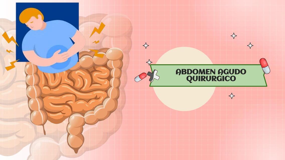ABDOMEN AGUDO | katty Ramirez | uDocz