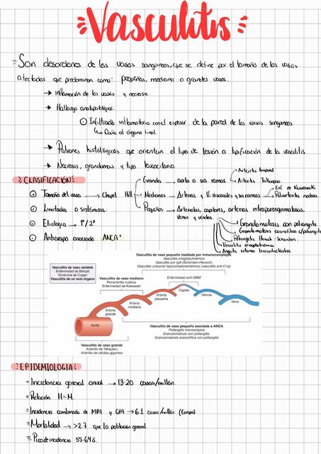 Vasculitis | Janeth Ramos | uDocz