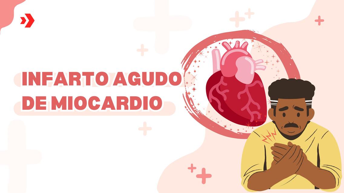 INFARTO AGUDO DE MIOCARDIO | Aresly Marin | uDocz