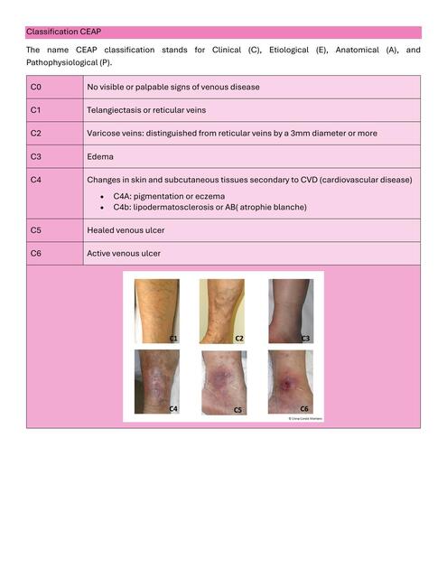 Classification CEAP Venous Insufficency based on STATPearls | Dani | uDocz