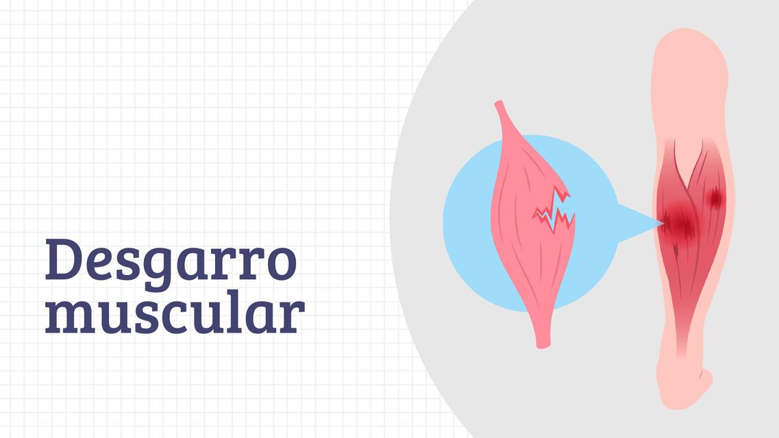 Flashcards de Desgarro muscular pdf | Por Samanta Ramírez | uDocz