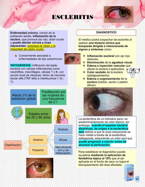 ESCLERITIS | Karen Jimenez | uDocz