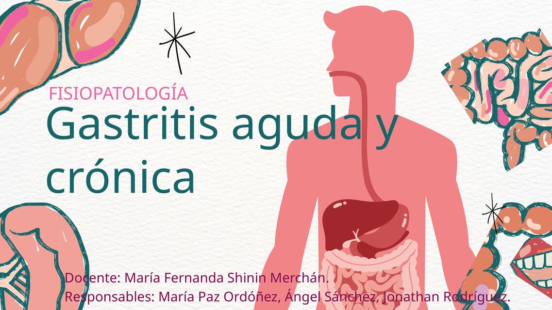 Fisiologia De Gastritis Aguda Y Crónica María Paz Ordóñez Udocz