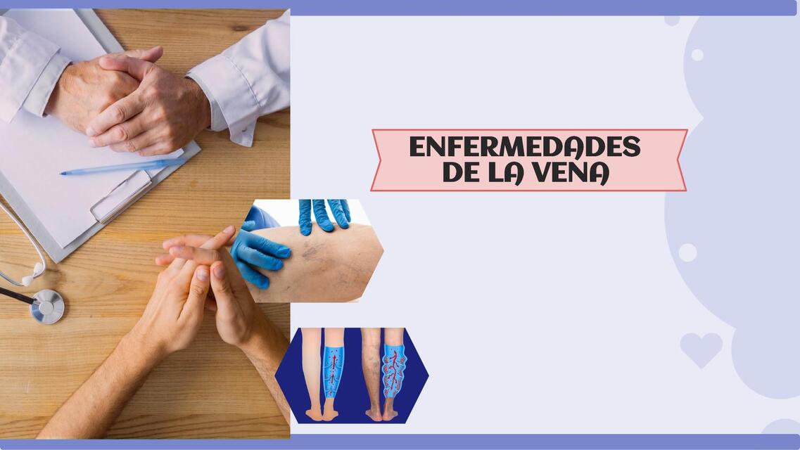 ENFERMEDADES DE LA VENA | katty Ramirez | uDocz
