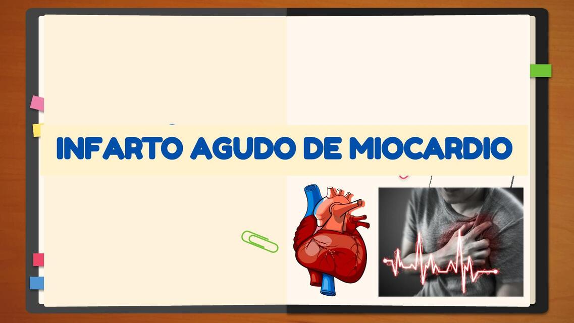 INFARTO AGUDO AL MIOCARDIO | katty Ramirez | uDocz