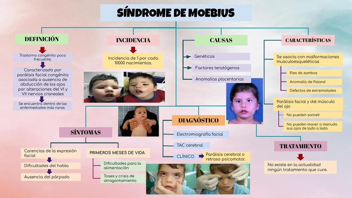SINDROME DE MOEBIUS | katty Ramirez | uDocz