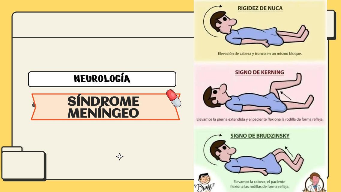 SÍNDROME MENÍNGEO | katty Ramirez | uDocz