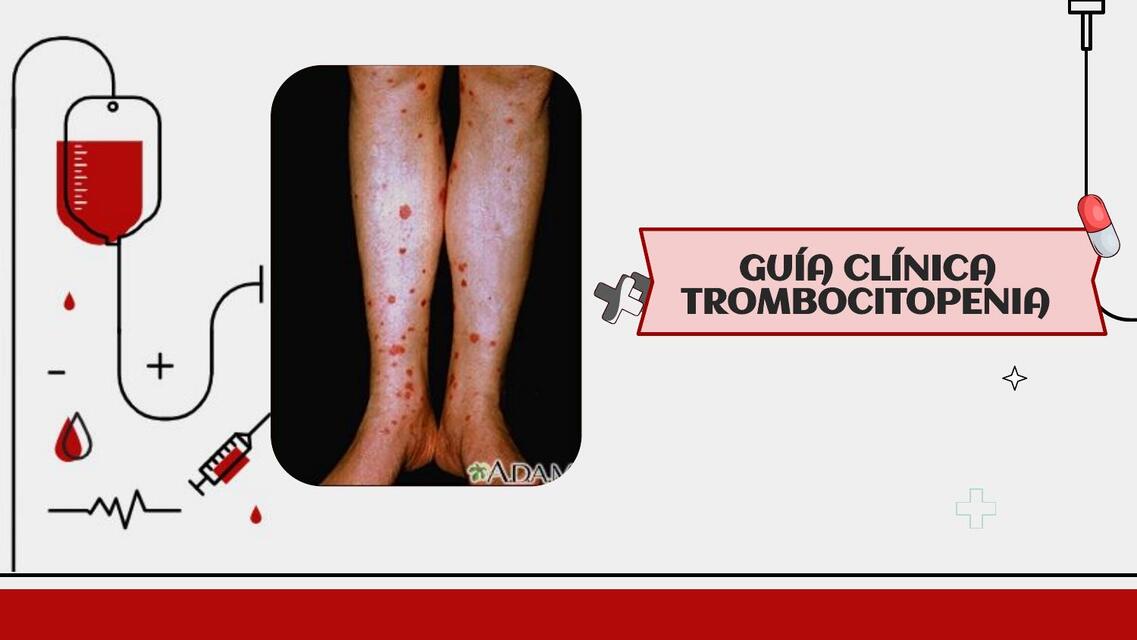 TROMBOCITOPENIA | katty Ramirez | uDocz