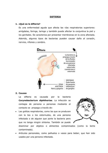 DIFTERIA | Jazmín HV | uDocz