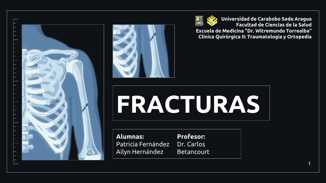 FRACTURAS AILYN Y PATY 2 | Ailyn Hernández | uDocz