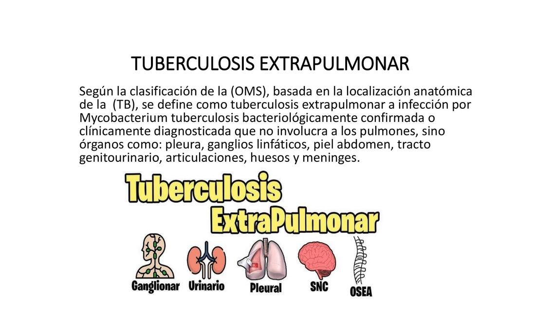 TUBERCULOSIS EXTRAPULMONAR | David | uDocz