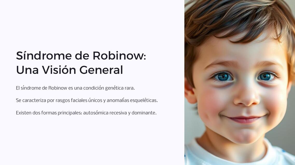 Sindrome de Robinow Una Vision General | Mirian | uDocz