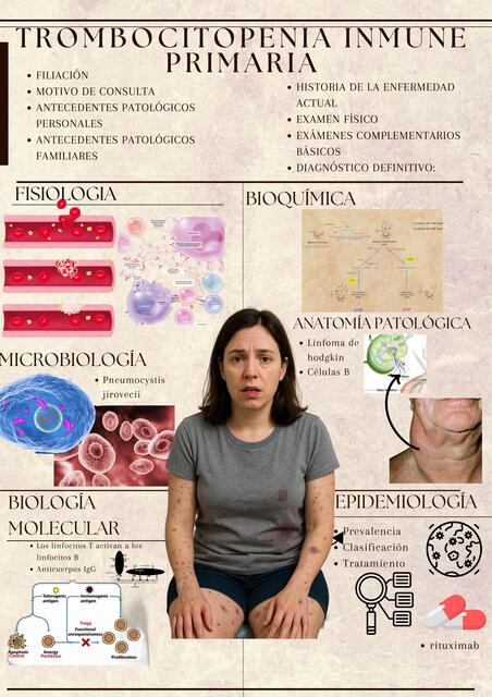 Trombocitopenia inmune primaria | SHELBY | uDocz