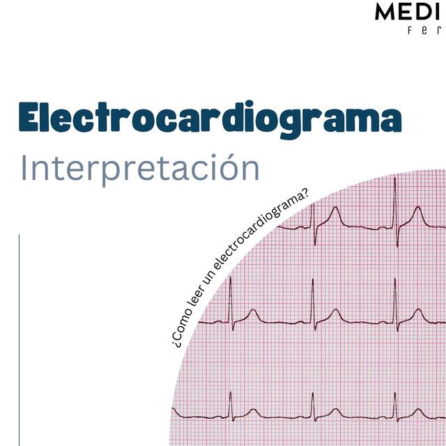 Interpretación electrocardiograma | medi_fer | uDocz
