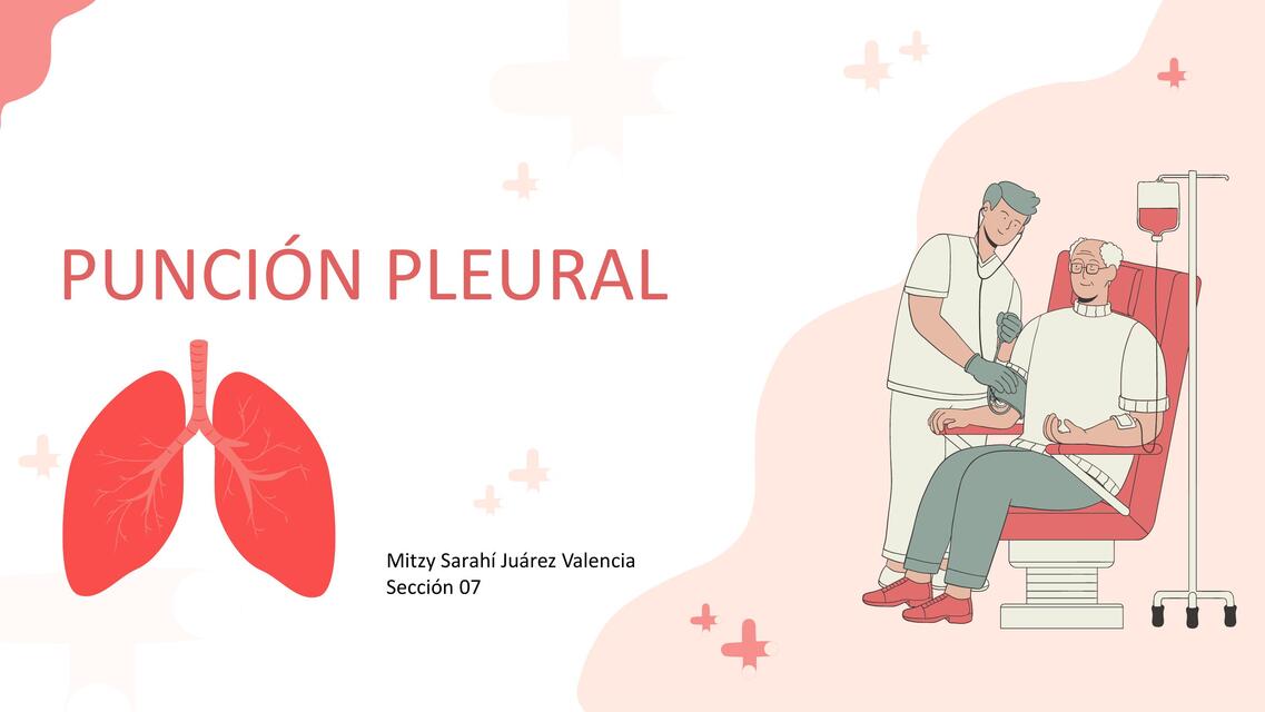 Flashcards de Punción pleural e hipoventilación | Por Mitzy Sarahi | uDocz