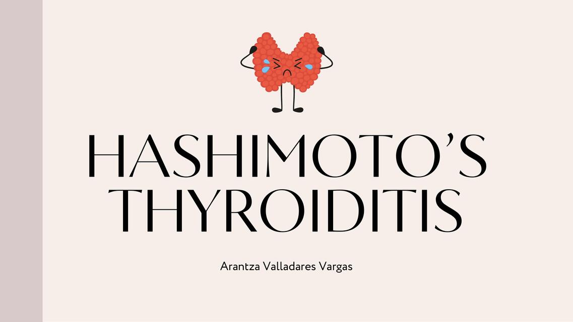 Hashimotos thyroiditis pdf | arantza | uDocz
