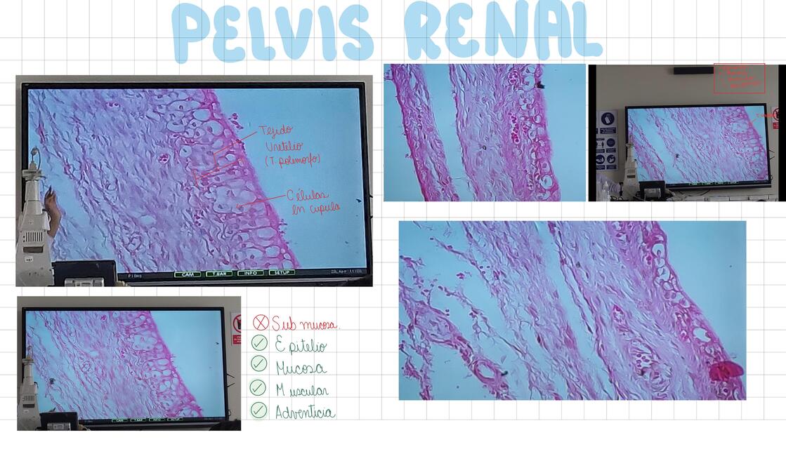 SISTEMA URINARIO | ALBITAH | uDocz