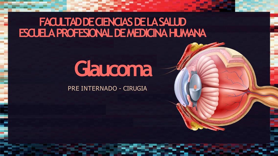 GLAUCOMA | Niquita Tanaka | uDocz