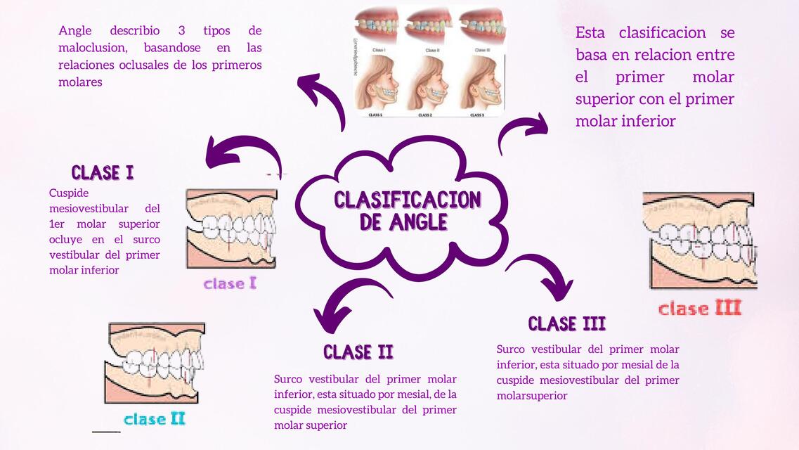 clasificacion de angle | Lilia | uDocz