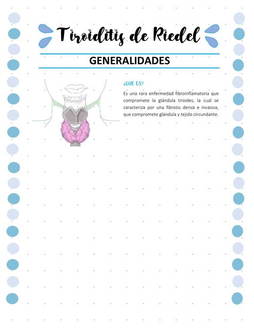 Tiroiditis de Riedel | Zoe Mandujano | uDocz
