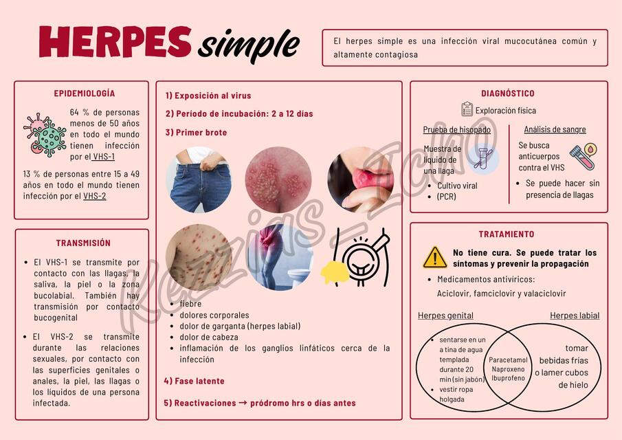 Herpes simple | kezzias_Icho | uDocz