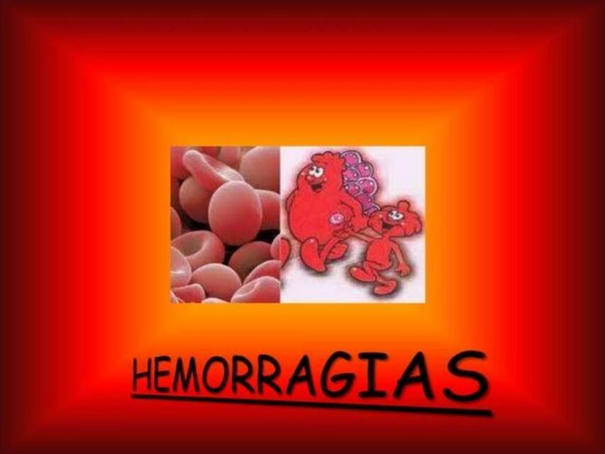 Hemorragia | Rocio Alanez | uDocz