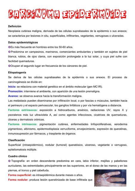 CARCINOMA EPIDERMOIDE | apun.tesmedicina | uDocz