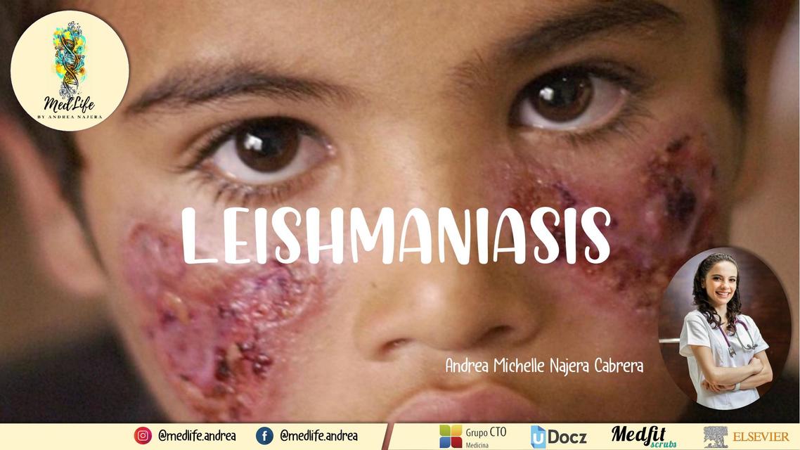 Leishmaniasis | Medlife.andrea | uDocz