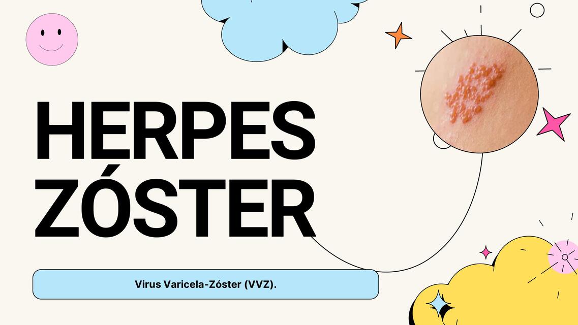 Herpes zoster | luna Ramírez | uDocz