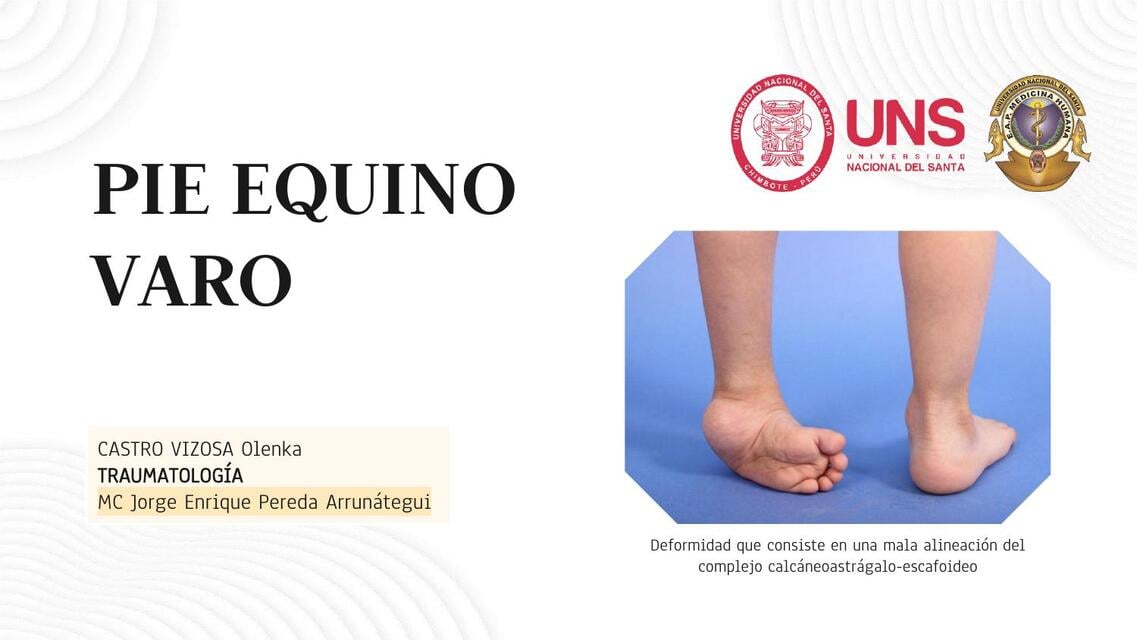 PIE EQUINO VARO.PPT | Olenka Castro | uDocz