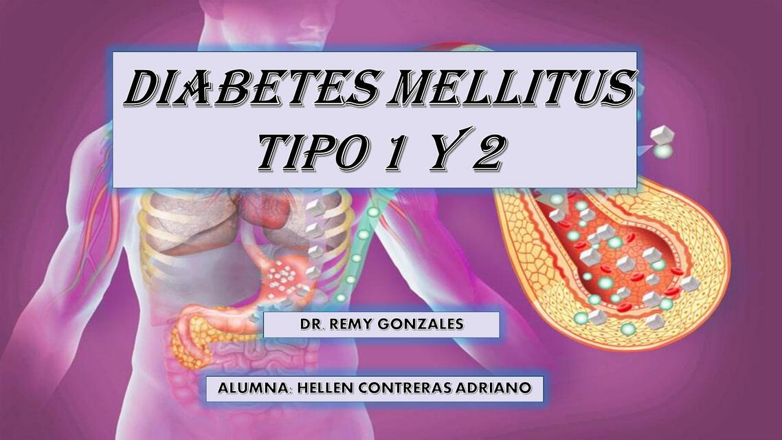 DIABETES MELLITUS | HELLEN SMITH CONTRERAS ADRIANO | uDocz