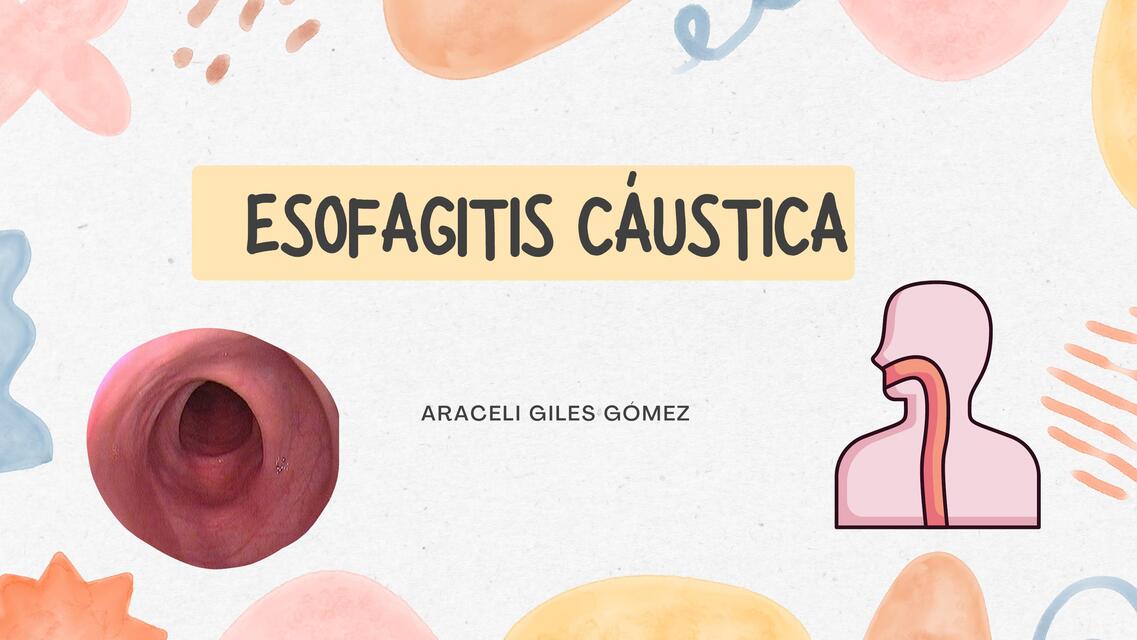Esofagitis Caustica | Araceli Giles Gómez | uDocz