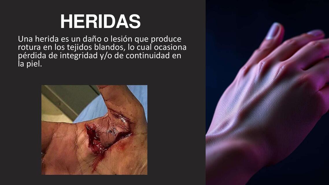 HERIDAS | Yecid | uDocz