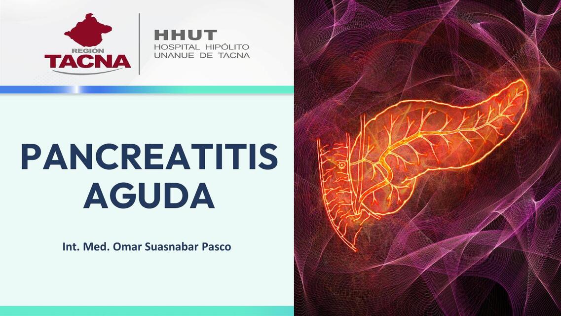 PANCREATITIS AGUDA | MEDICINA 360° | uDocz