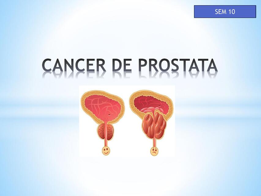 CANCER PROSTRATA | Milagros | uDocz