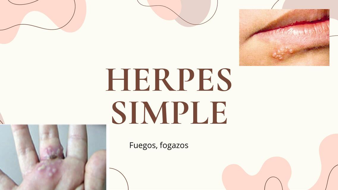 Virosis cutáneas herpes | Alejandra | uDocz