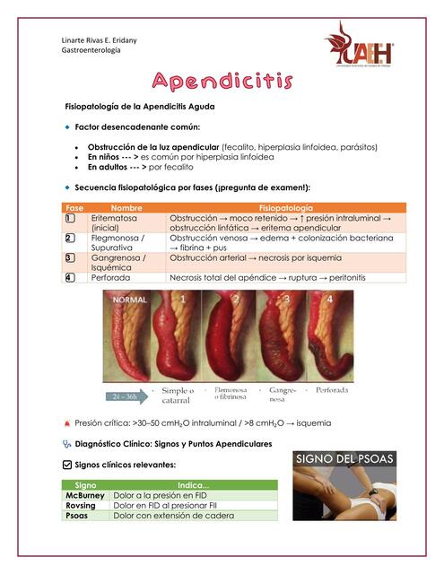 Apendicitis | Eridany Linarte | uDocz