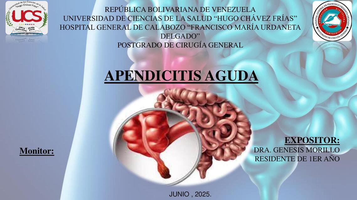 Flashcards de Apendicitis | Por Genesis | uDocz