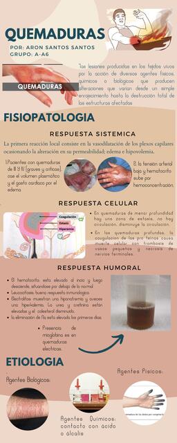 SANTOS SANTOS ARON INFOGRAFIA SOBRE QUEMADURAS | Aron Santos | uDocz