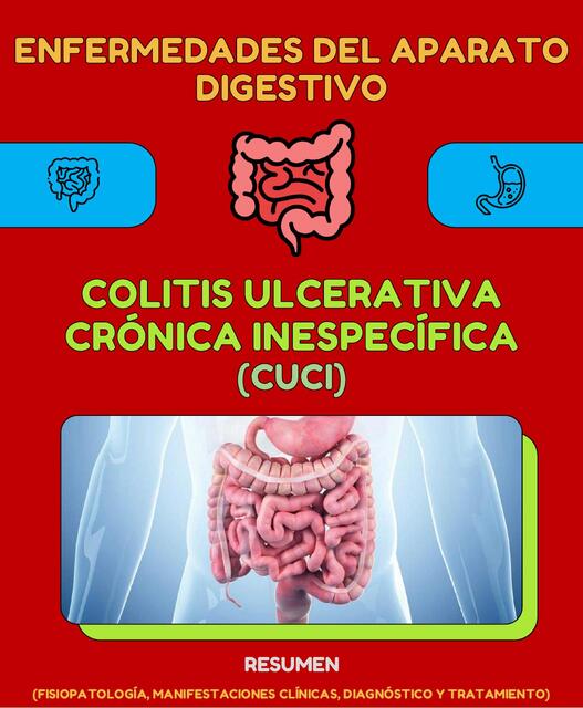 Colitis ulcerativa crónica inespecífica CUCI | Javier Rios | uDocz