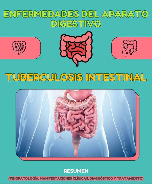 Tuberculosis intestinal | Javier Rios | uDocz