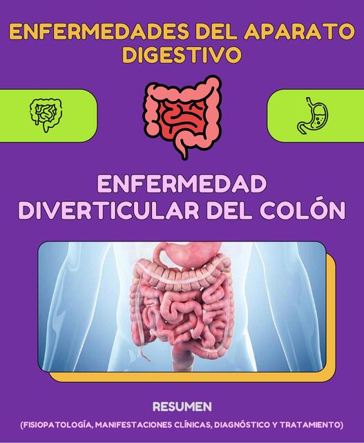 Enfermedad diverticular del colon diverticulitis | Javier Rios | uDocz