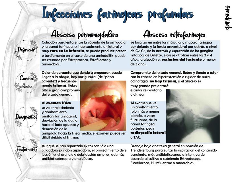 Infecciones Faringeas Profundas | Medicine Ink | uDocz