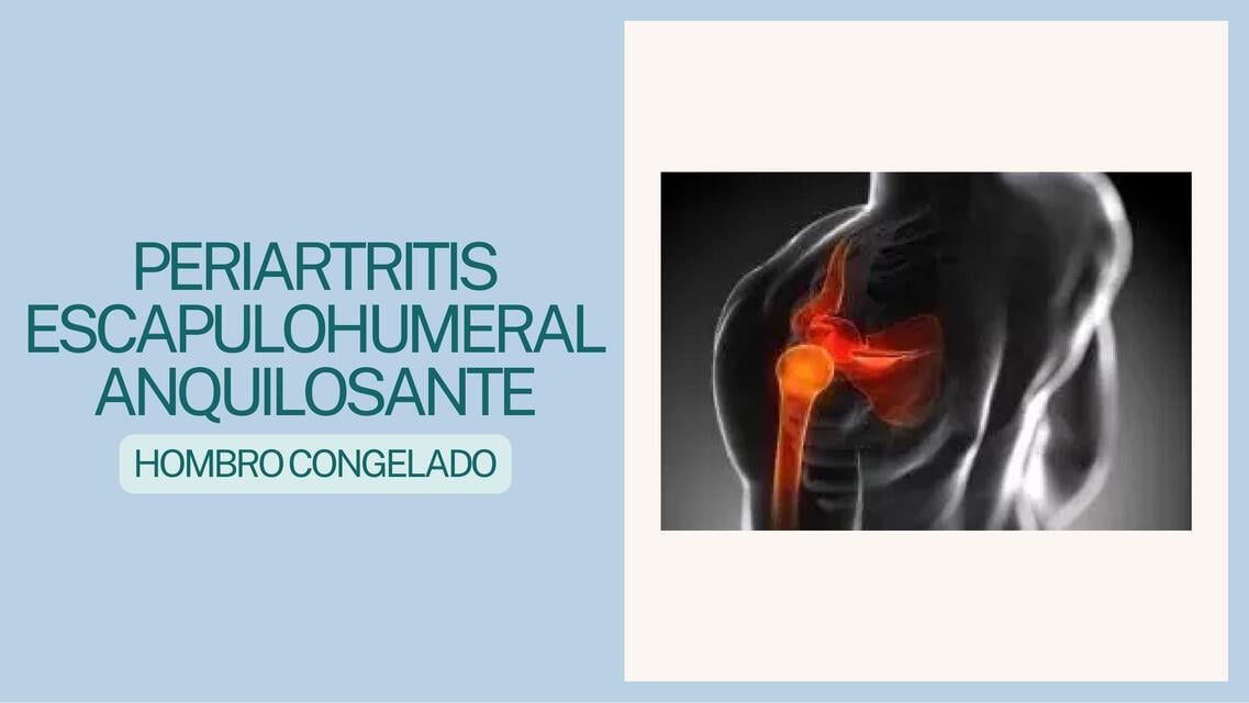 PERIARTRITIS ESCAPULOHUMERAL ANQUILOSANTE pdf | rene | uDocz