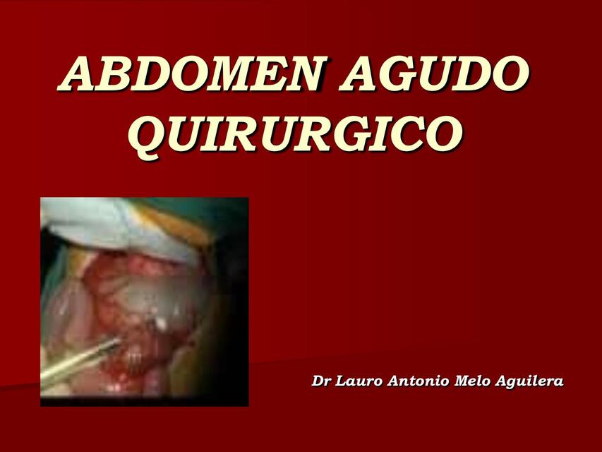 Flashcards de ABDOMEN AGUDO QUIRURGICO | Por Miguel | uDocz