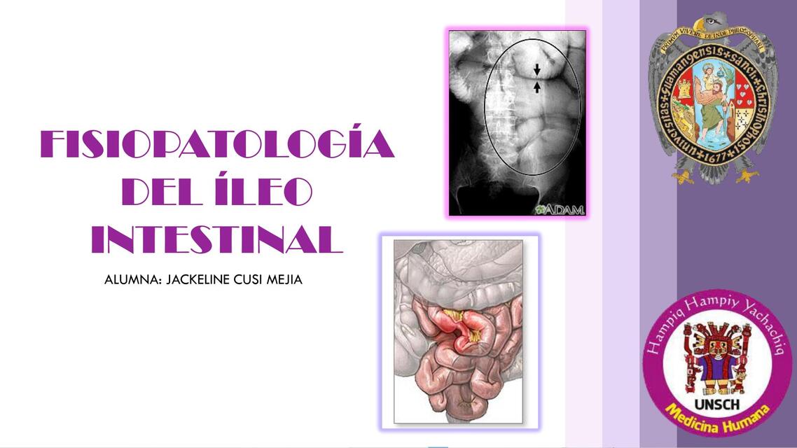 Fisiopatología del íleo intestinal | Jackeline | uDocz