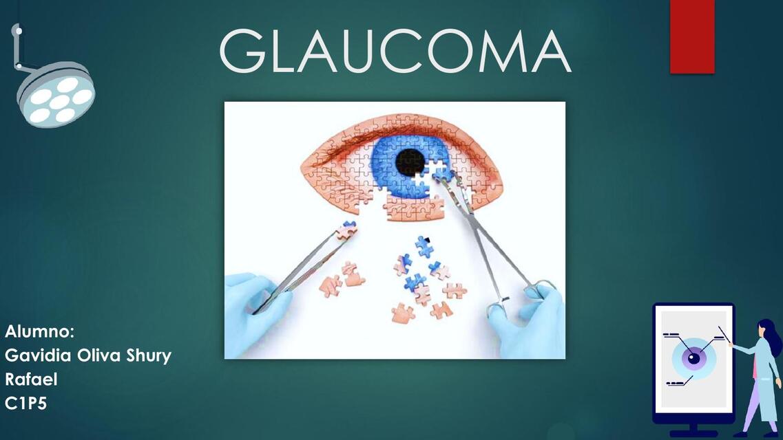glaucoma oftalmologia | Shury Rafael Oliva | uDocz